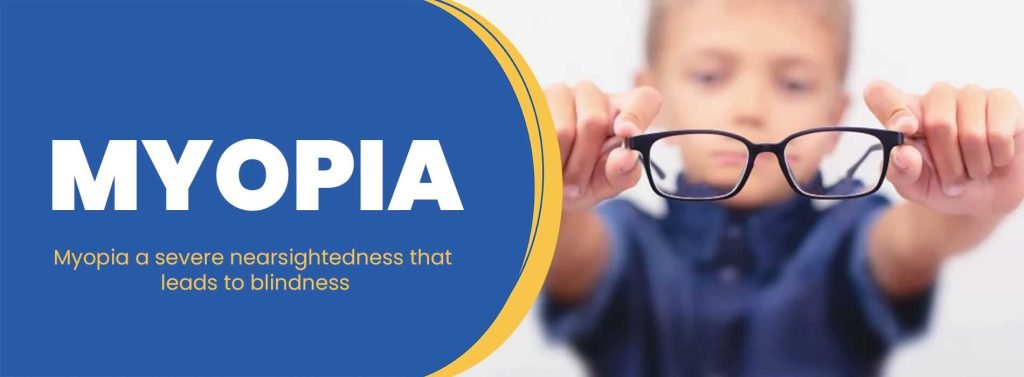 Myopia - Ashu Laser Vision